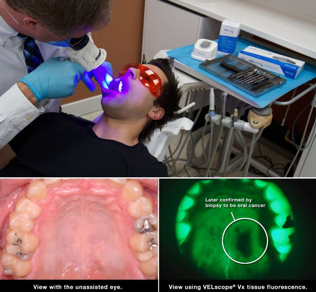 VELscope - A DR Care Solutions Trusted Provider